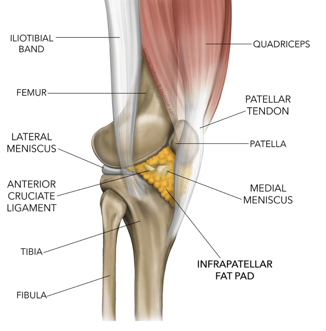 Knee Fat Pad Impingement Impingement Hoffa s Fat Pad