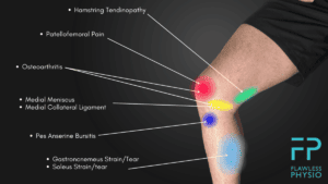 Knee Pain Location Chart - Find the Cause of Your Knee Pain