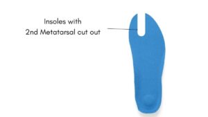 Capsulitis of the Second Toe: Symptoms, Treatment and Exercises